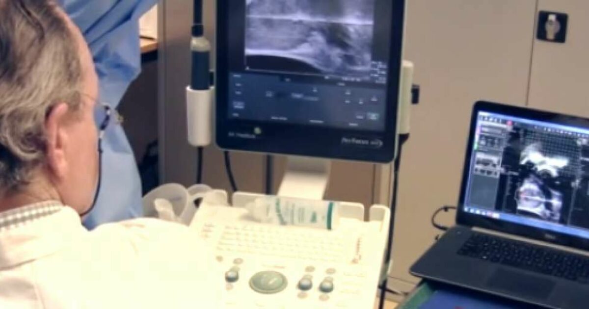 'Fusie-biopsie' voorspelt prostaatkanker patiëntvriendelijk | Change Inc.